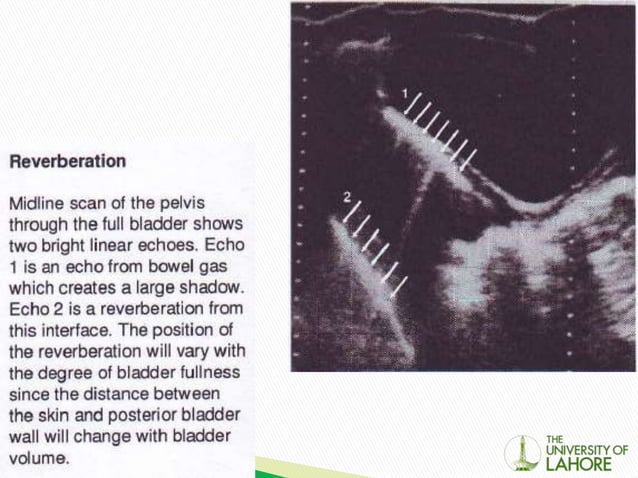 Artifacts in Ultrasound.pptx( by Jalil Hanafi) | PPTX | Digital Audio | Computer Software and ...