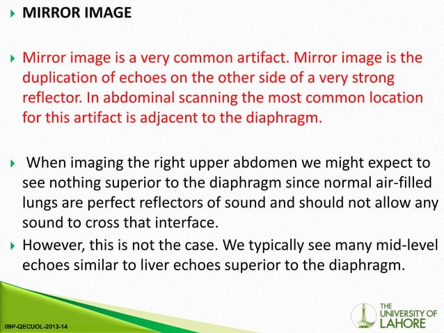 Artifacts in Ultrasound.pptx( by Jalil Hanafi) | PPTX | Digital Audio | Computer Software and ...