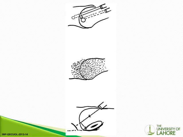 Artifacts in Ultrasound.pptx( by Jalil Hanafi) | PPTX | Digital Audio | Computer Software and ...