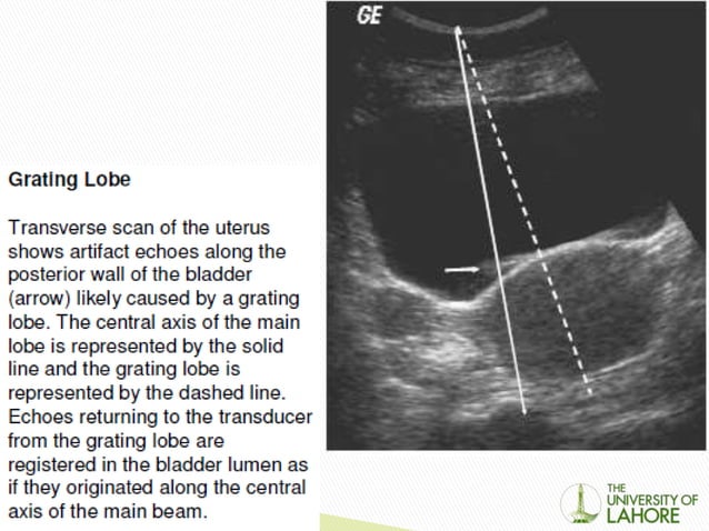 Artifacts in Ultrasound.pptx( by Jalil Hanafi) | PPTX | Digital Audio | Computer Software and ...