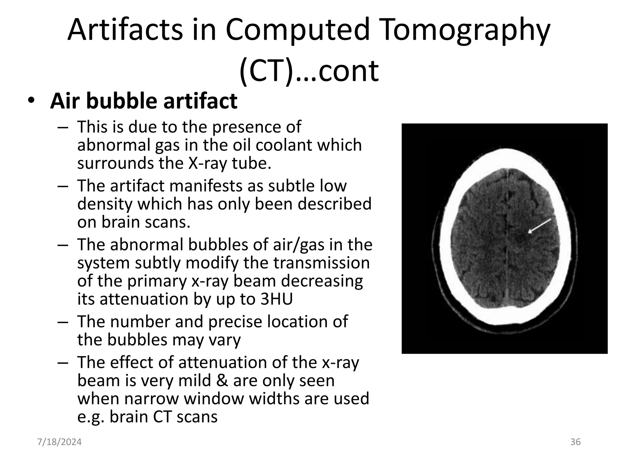ARTIFACTS IN IMAGING MODALITIES. power ptx | PPTX