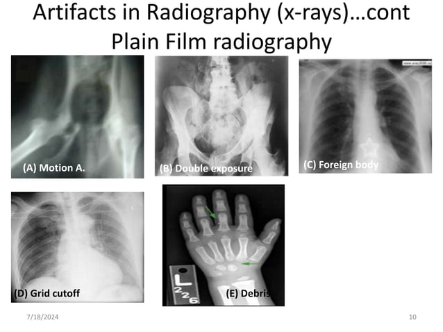 ARTIFACTS IN IMAGING MODALITIES. power ptx | PPTX