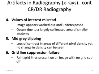 ARTIFACTS IN IMAGING MODALITIES. power ptx | PPTX