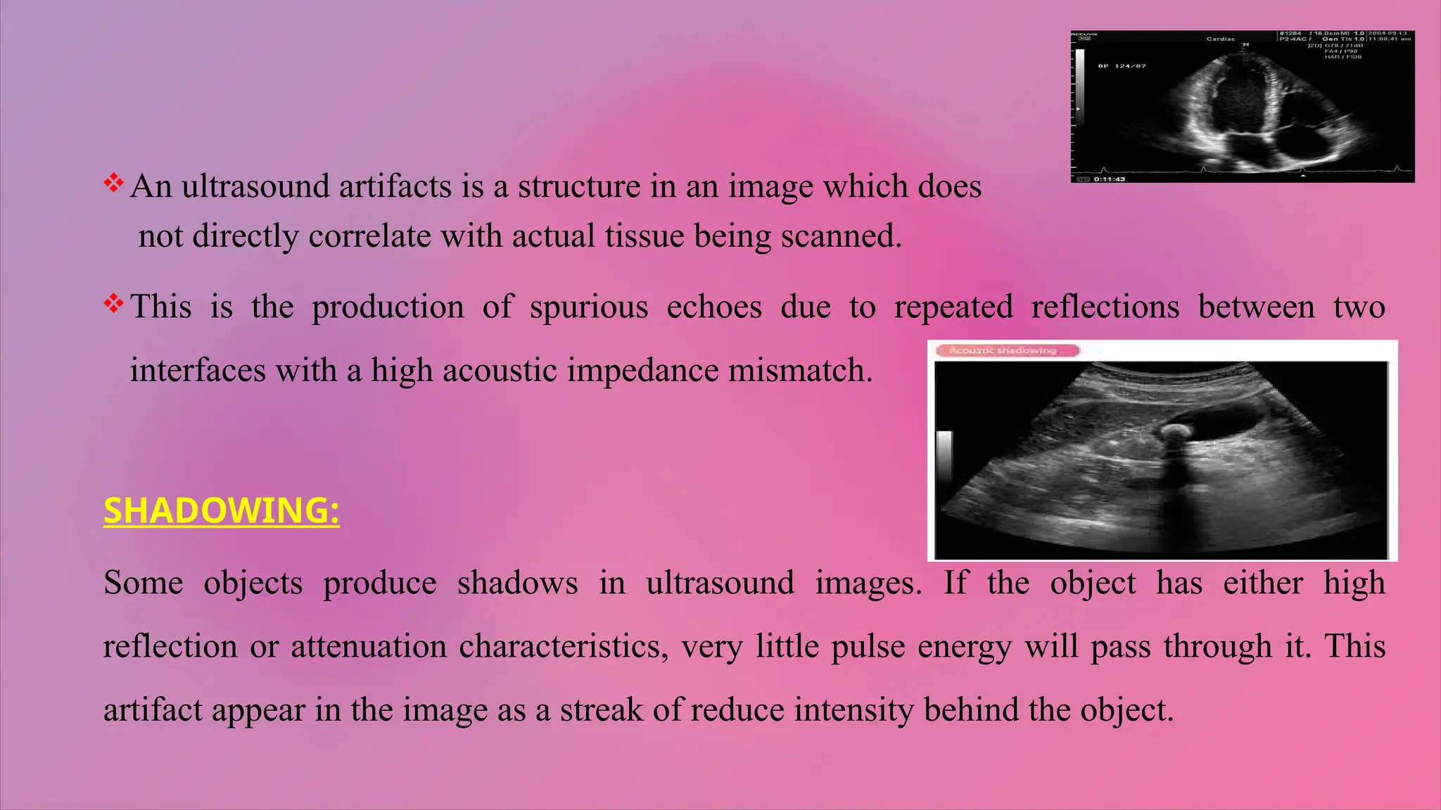 DIFFERENT TYPES OF ULTRASOUND. ARTIFACTS | PPTX