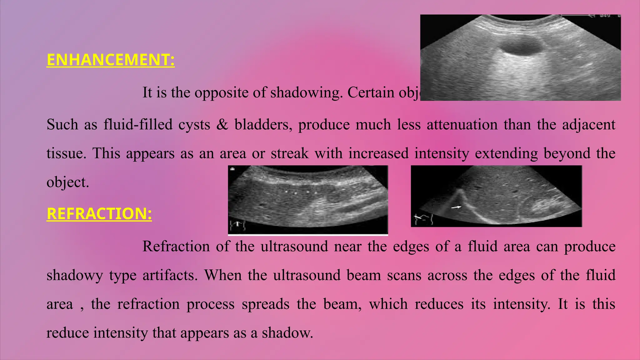 DIFFERENT TYPES OF ULTRASOUND. ARTIFACTS | PPTX