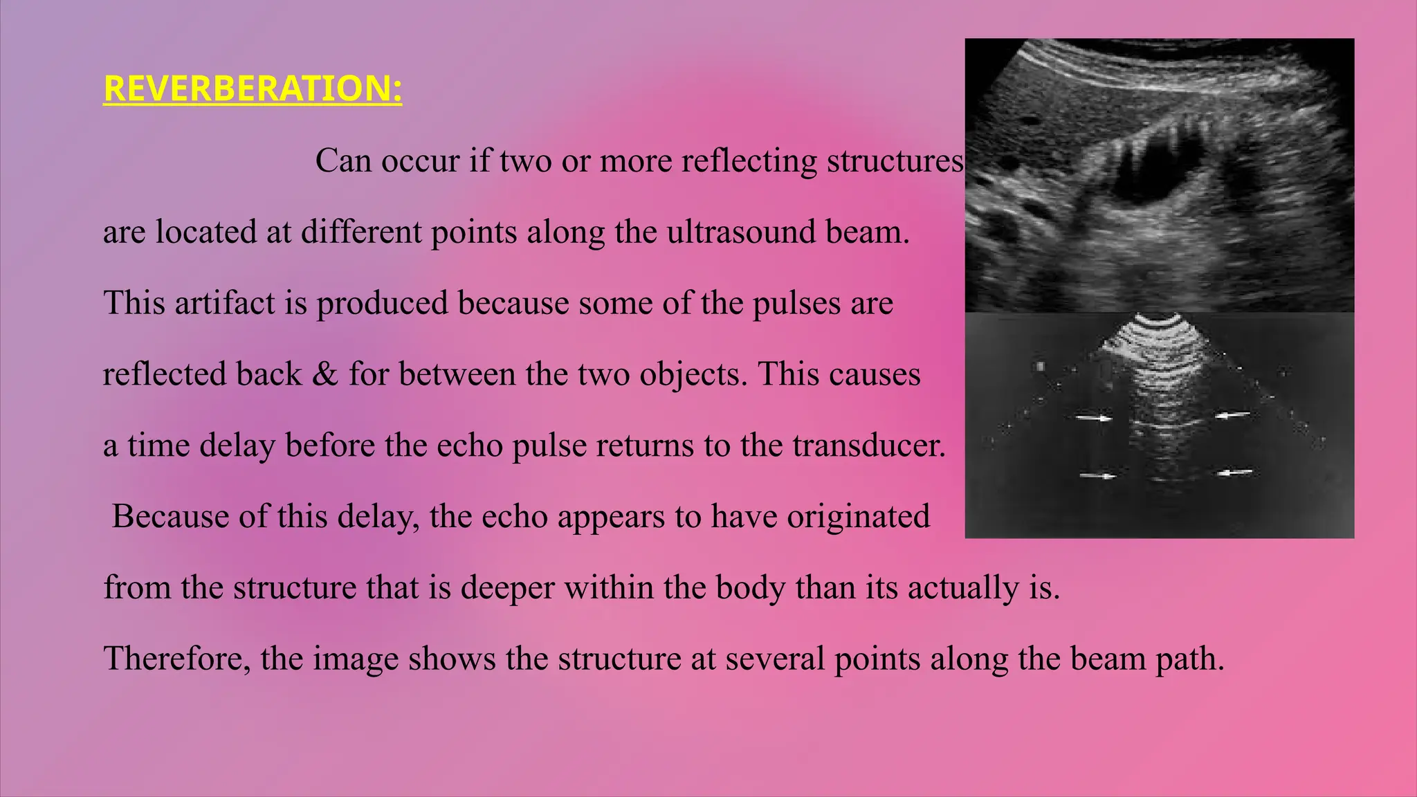 DIFFERENT TYPES OF ULTRASOUND. ARTIFACTS | PPTX