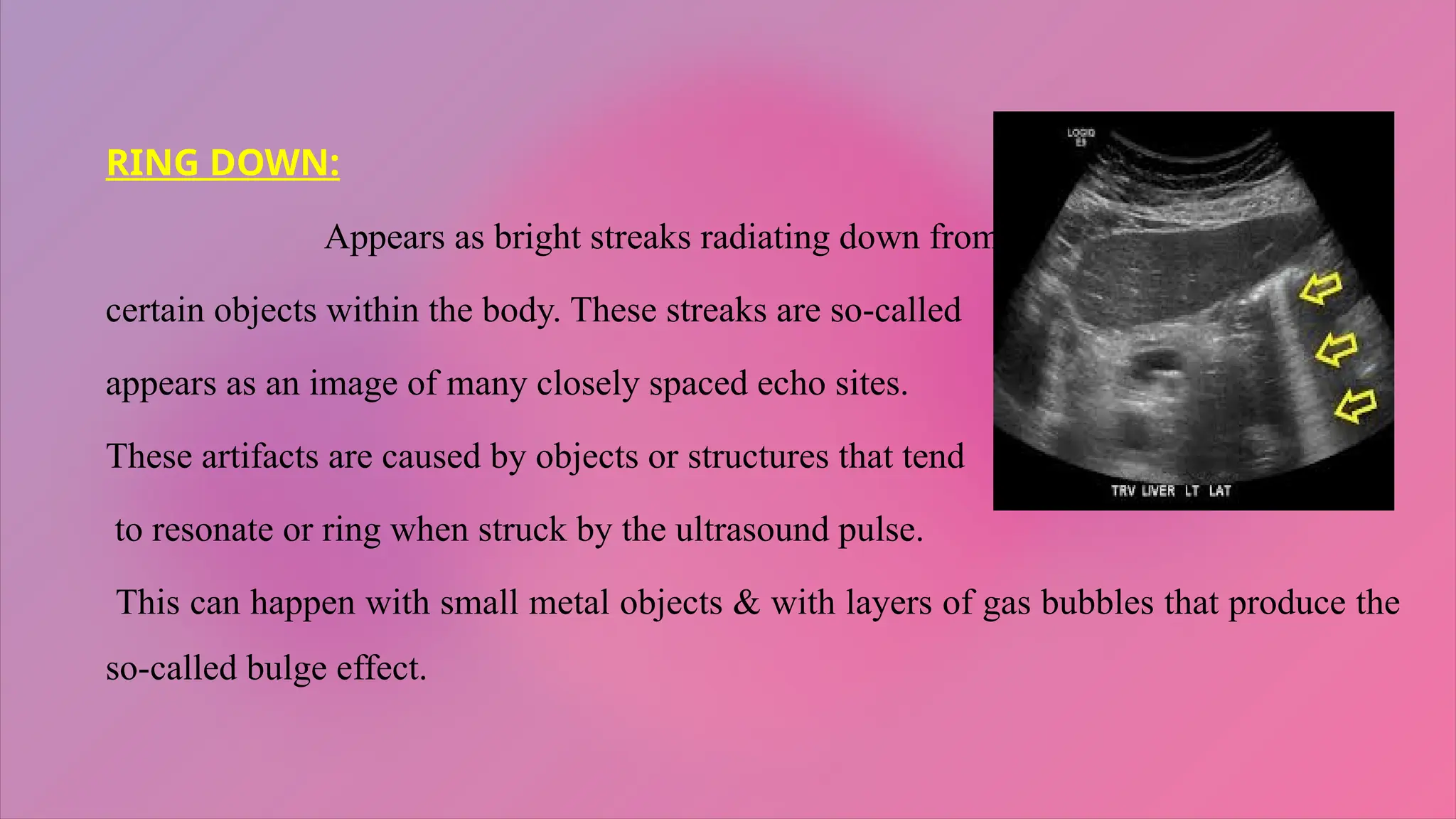 DIFFERENT TYPES OF ULTRASOUND. ARTIFACTS | PPTX