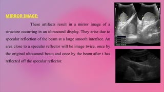 DIFFERENT TYPES OF ULTRASOUND. ARTIFACTS | PPTX