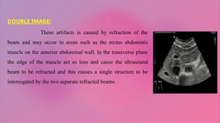 DIFFERENT TYPES OF ULTRASOUND. ARTIFACTS | PPTX