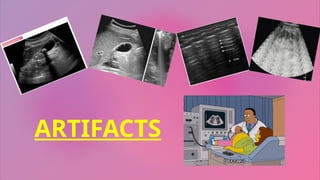 DIFFERENT TYPES OF ULTRASOUND. ARTIFACTS | PPTX
