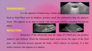 DIFFERENT TYPES OF ULTRASOUND. ARTIFACTS | PPTX