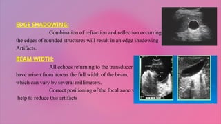DIFFERENT TYPES OF ULTRASOUND. ARTIFACTS | PPTX