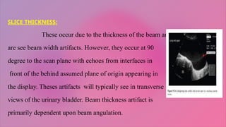 DIFFERENT TYPES OF ULTRASOUND. ARTIFACTS | PPTX