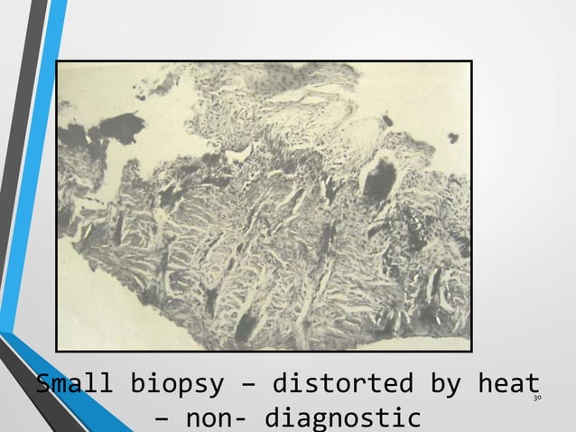 Artifacts in Tissue processing | PPTX
