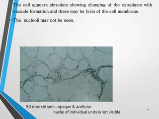 Artifacts in Tissue processing | PPTX