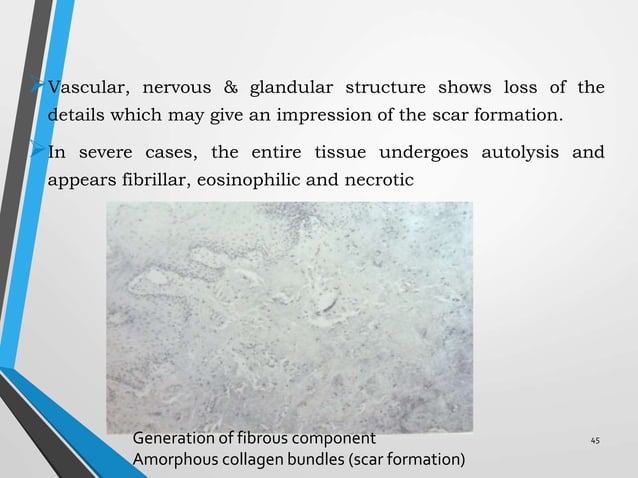 Artifacts in Tissue processing | PPTX
