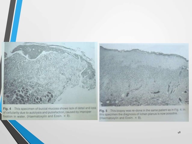 Artifacts in Tissue processing | PPTX