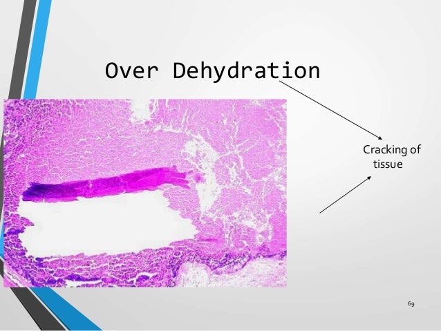 Artifacts in Tissue processing