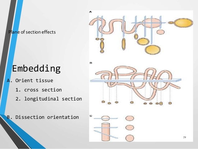 Artifacts in Tissue processing