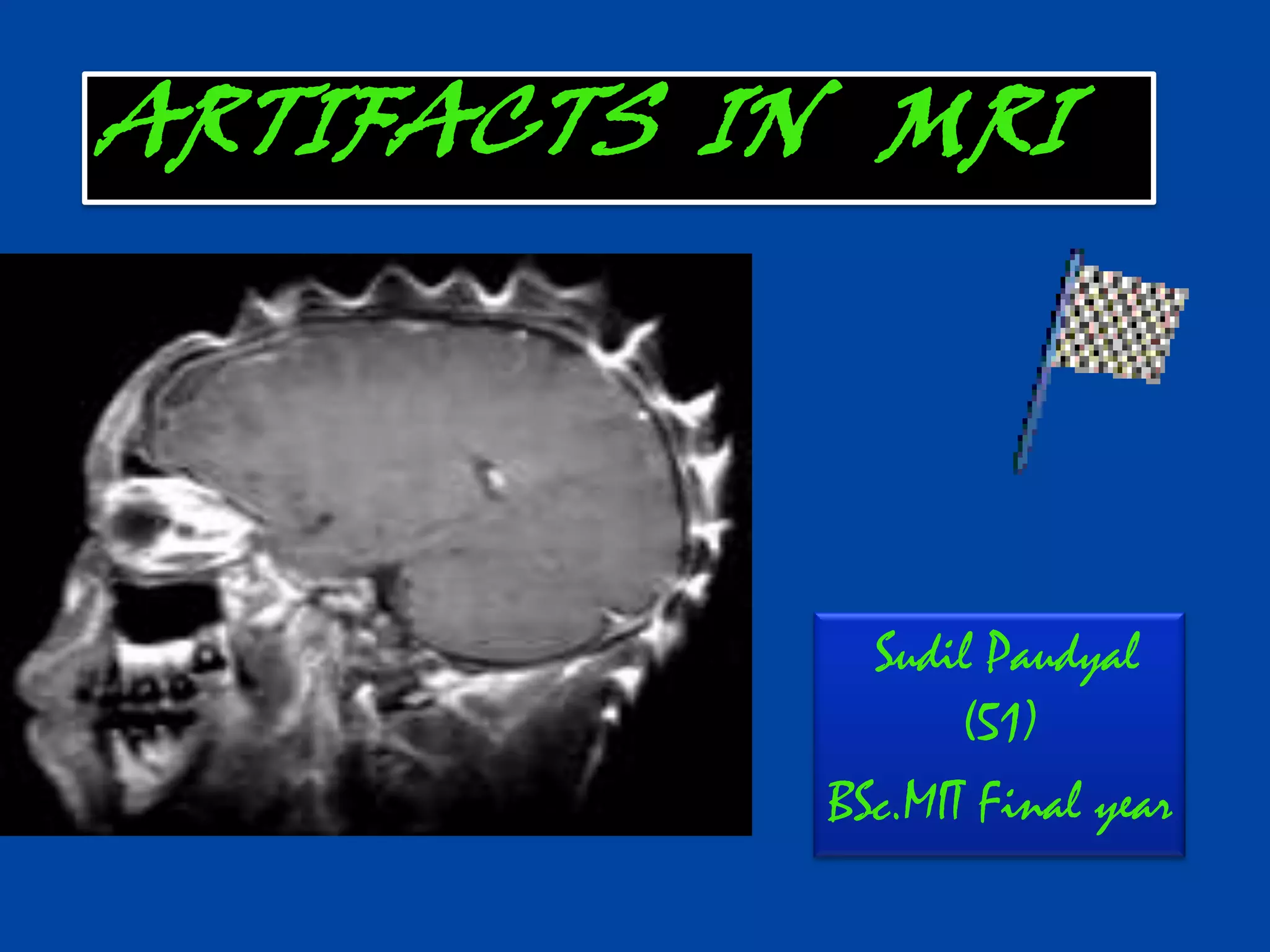 MRI artifacts | PPTX