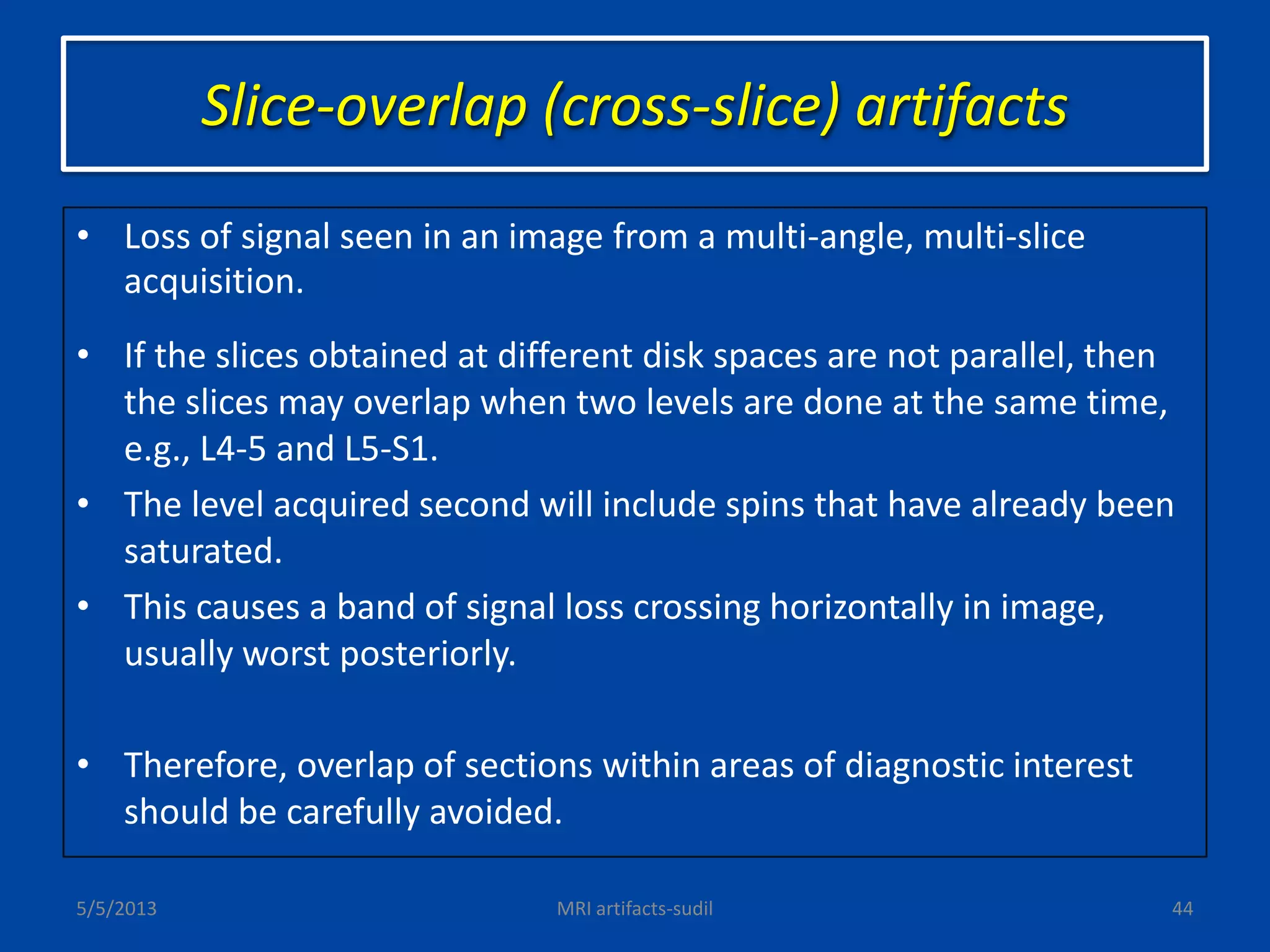 MRI artifacts | PPTX