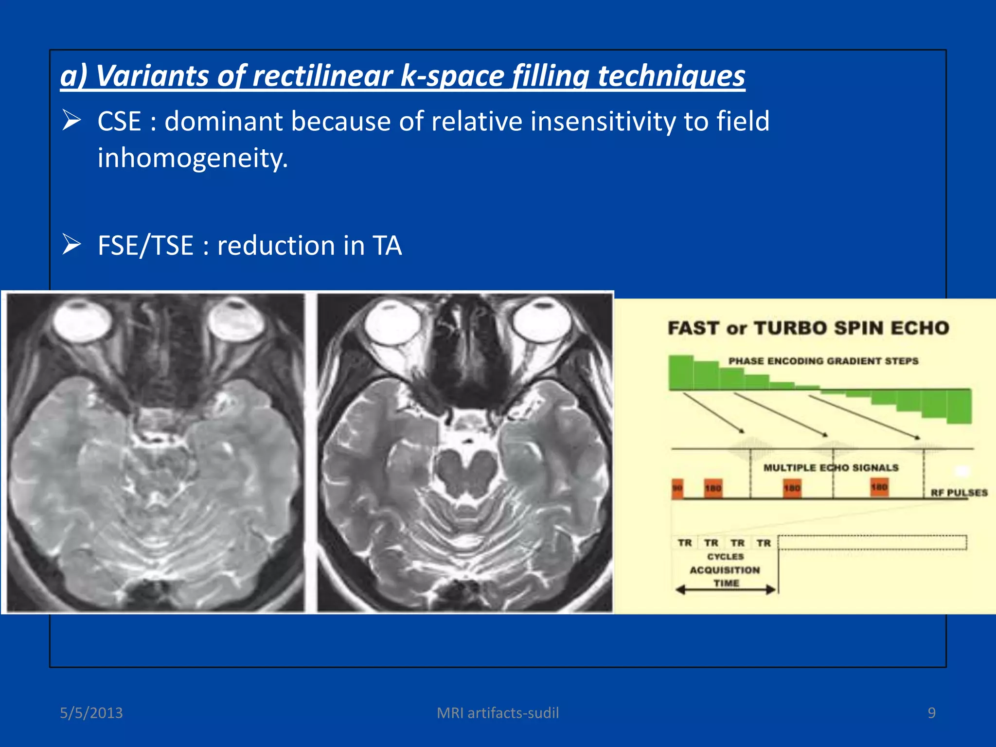 MRI artifacts | PPTX