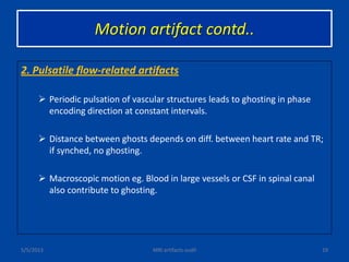 MRI artifacts | PPTX