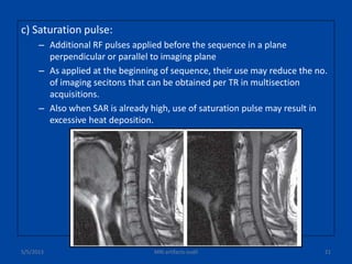 MRI artifacts | PPTX