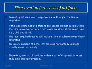 MRI artifacts | PPTX