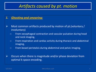 MRI artifacts | PPTX