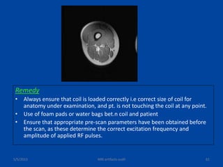 MRI artifacts | PPTX