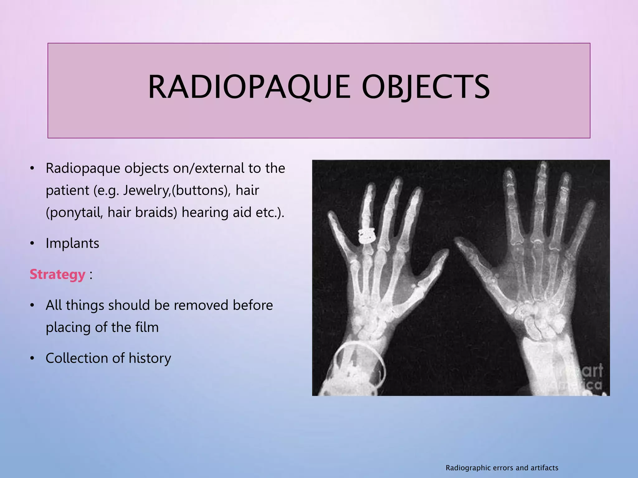 Artifacts in conventional radiology.pptx
