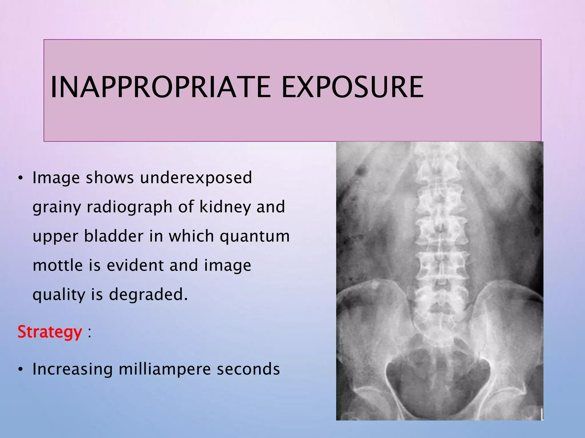 Artifacts in conventional radiology.pptx