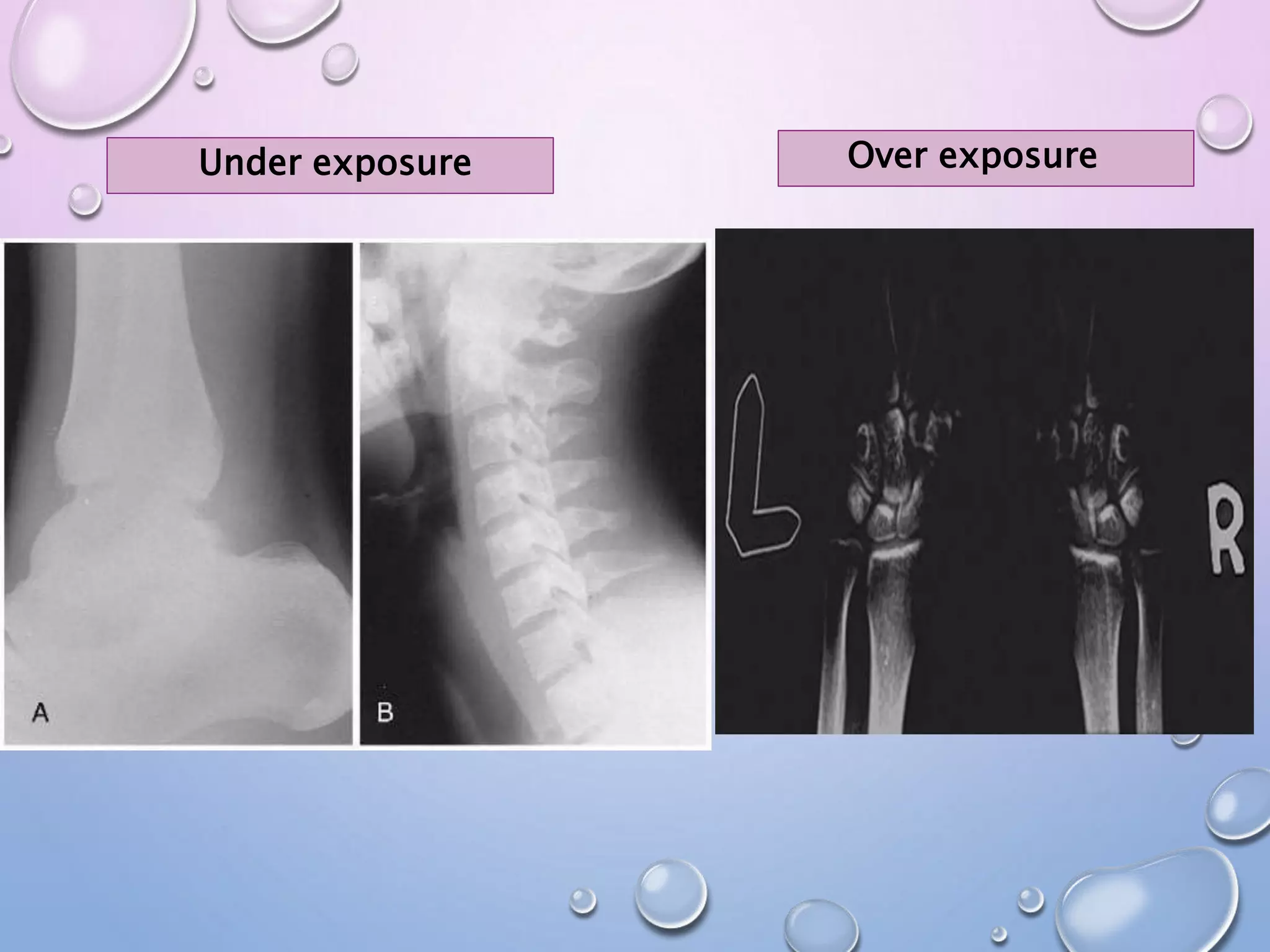 Artifacts in conventional radiology.pptx