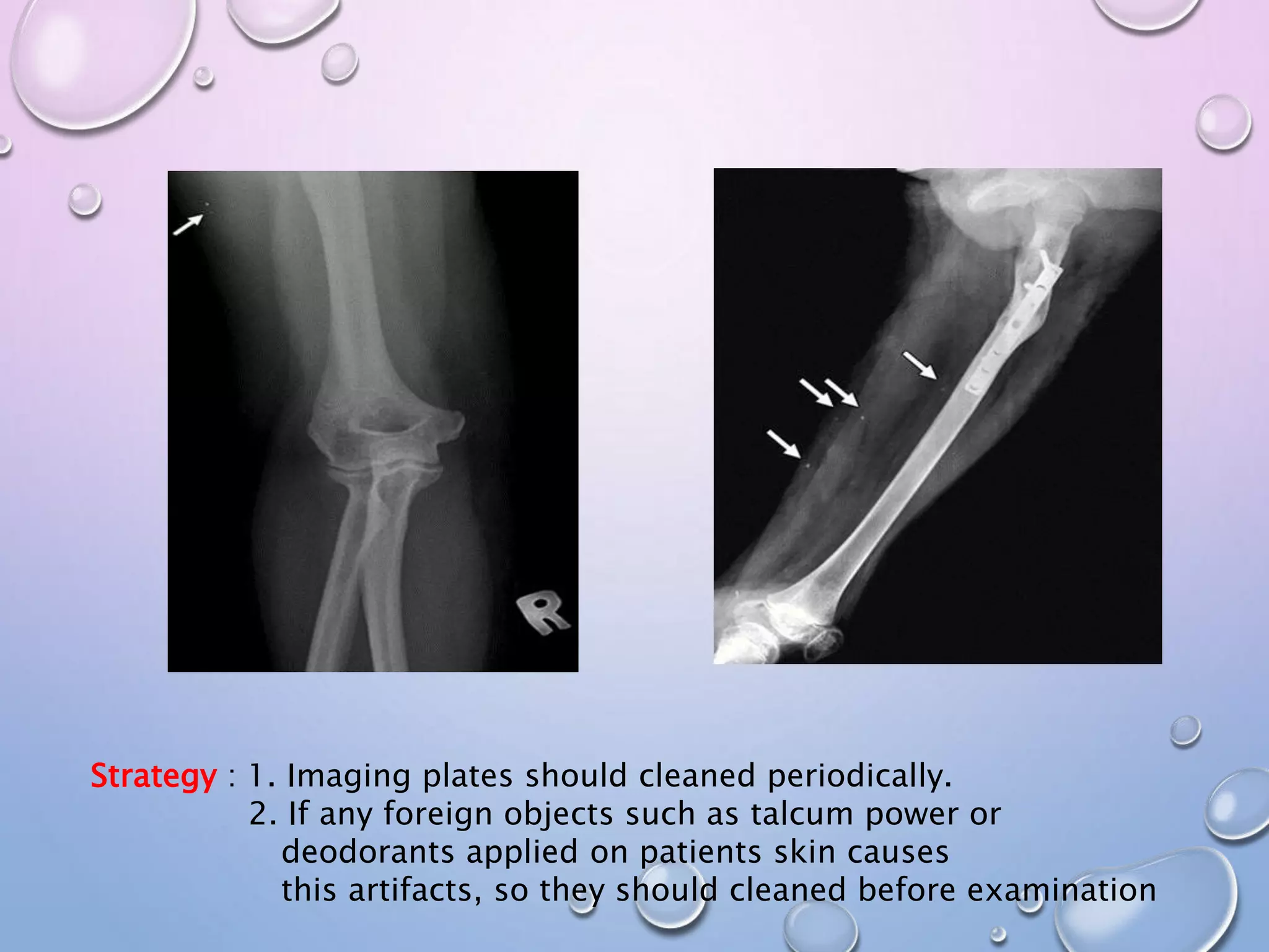 Artifacts in conventional radiology.pptx
