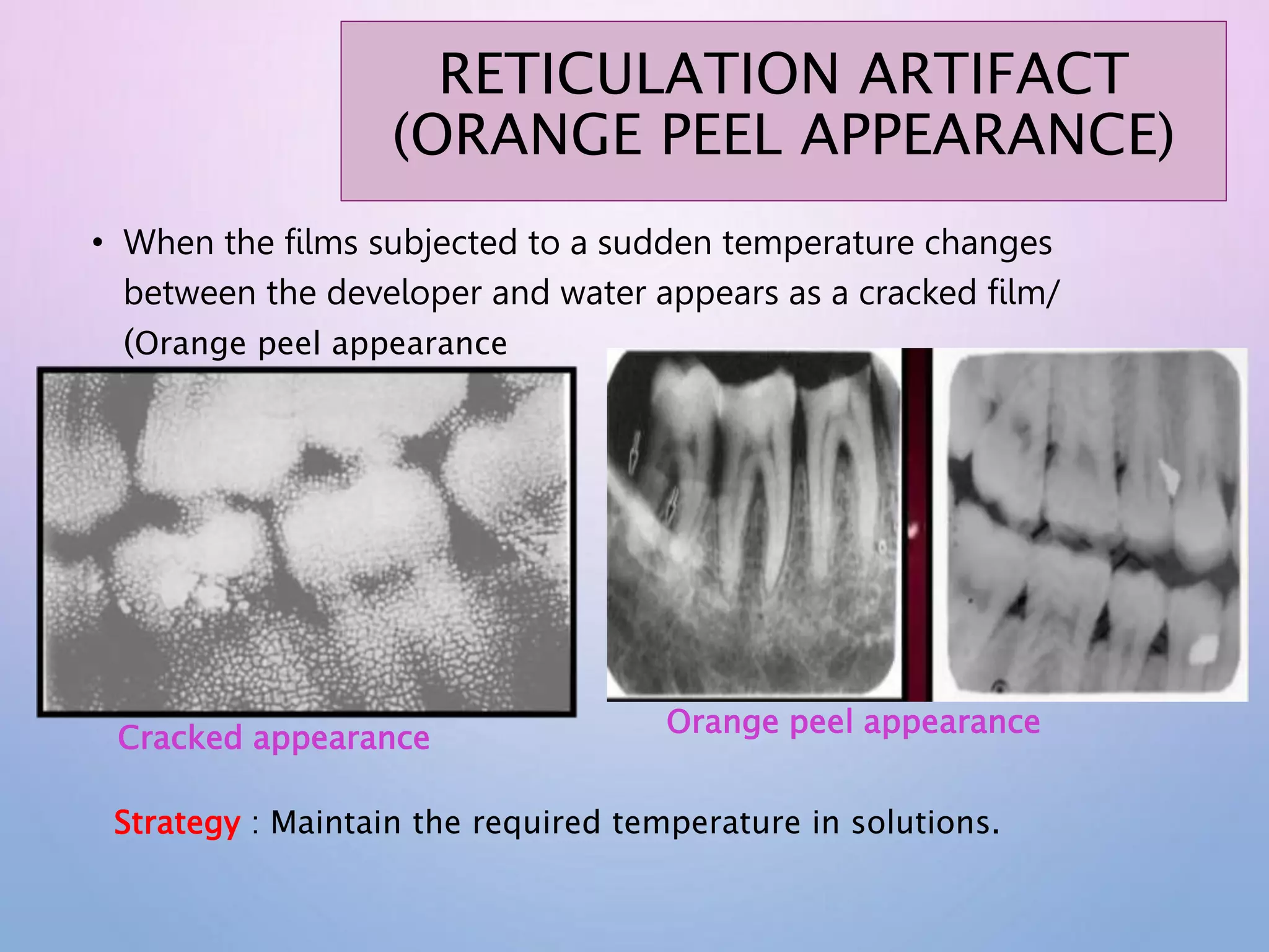 Artifacts in conventional radiology.pptx