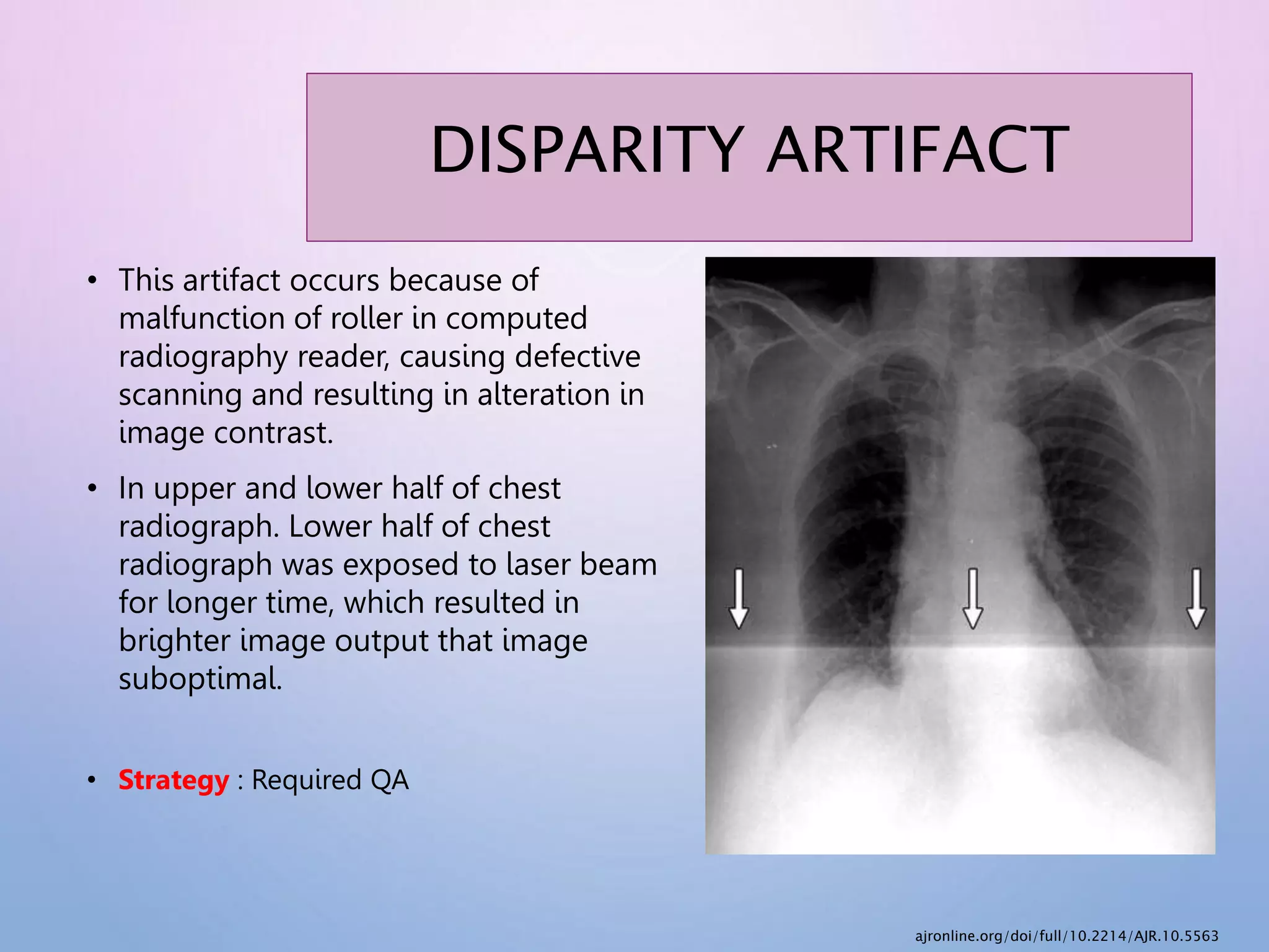 Artifacts in conventional radiology.pptx