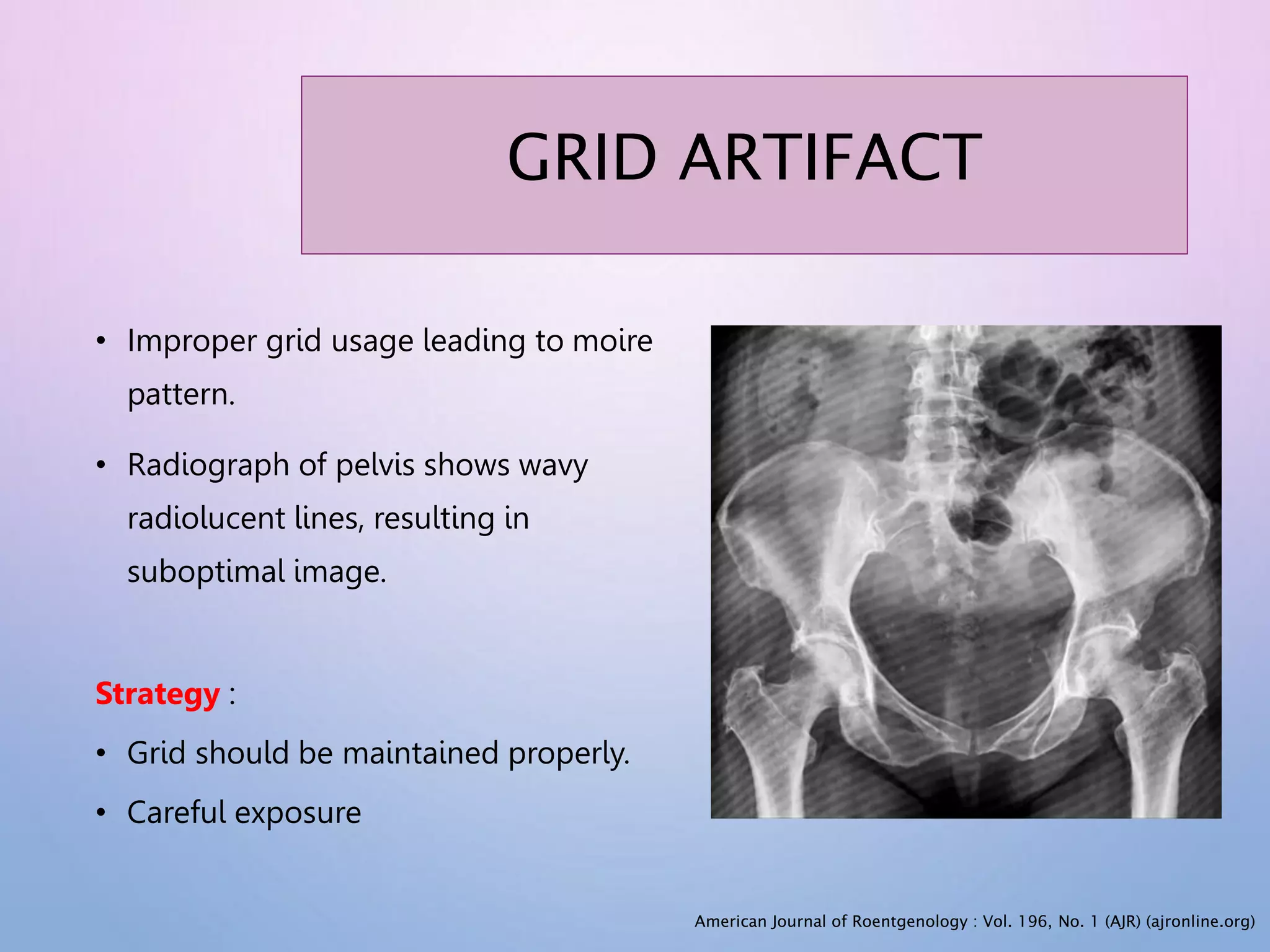 Artifacts in conventional radiology.pptx