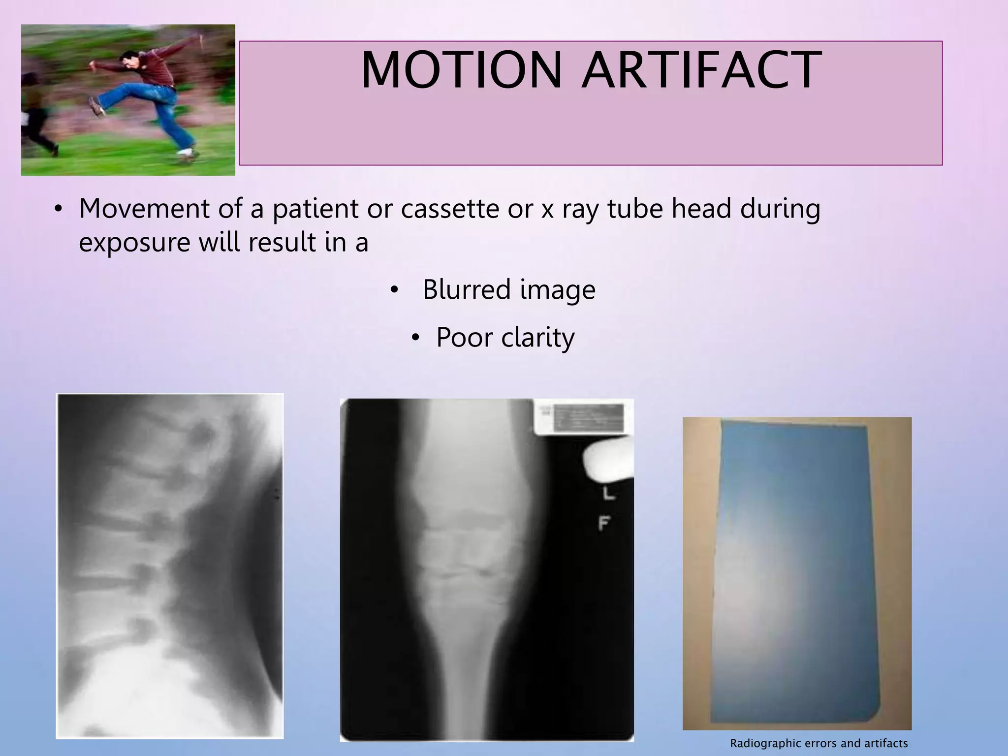 Artifacts in conventional radiology.pptx