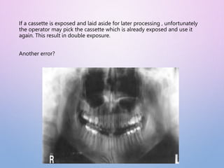 Artifacts in conventional radiology.pptx