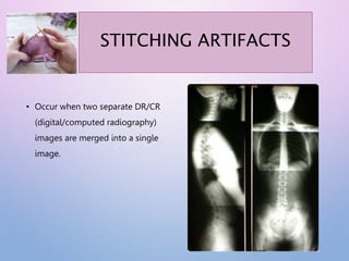 Artifacts in conventional radiology.pptx