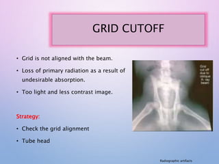 Artifacts in conventional radiology.pptx