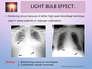 Artifacts in conventional radiology.pptx