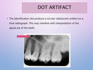 Artifacts in conventional radiology.pptx