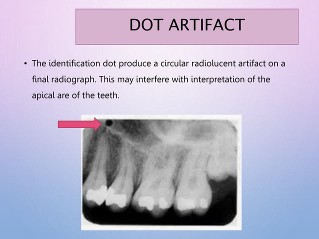 Artifacts in conventional radiology.pptx