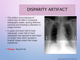 Artifacts in conventional radiology.pptx