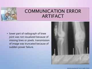 Artifacts in conventional radiology.pptx