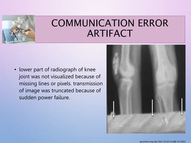 Artifacts in conventional radiology.pptx
