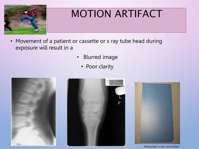 Artifacts in conventional radiology.pptx