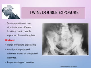 Exposure To X Ray